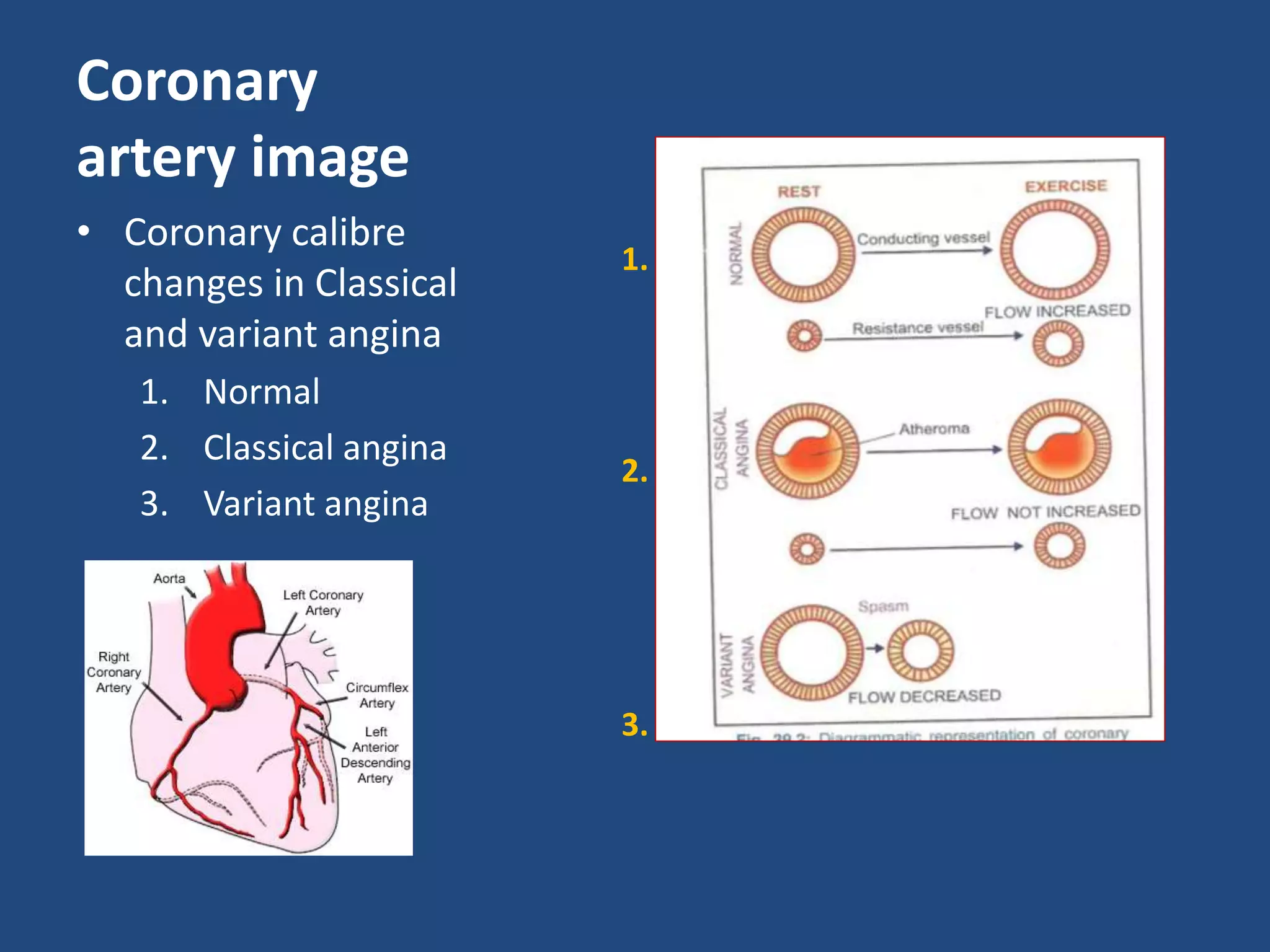 Antianginal drugs and drugs used in ischaemia - drdhriti | PPTX