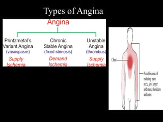Antianginal lecture | PPT