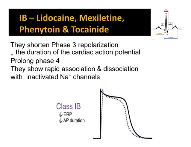 Anti arrhthymic drugs | PPT