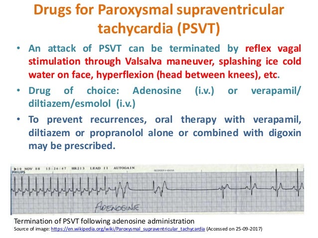 Antiarrhythmic agent