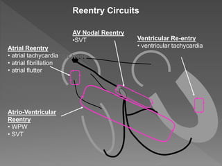 Antiarrhythmic drugs | PPTX