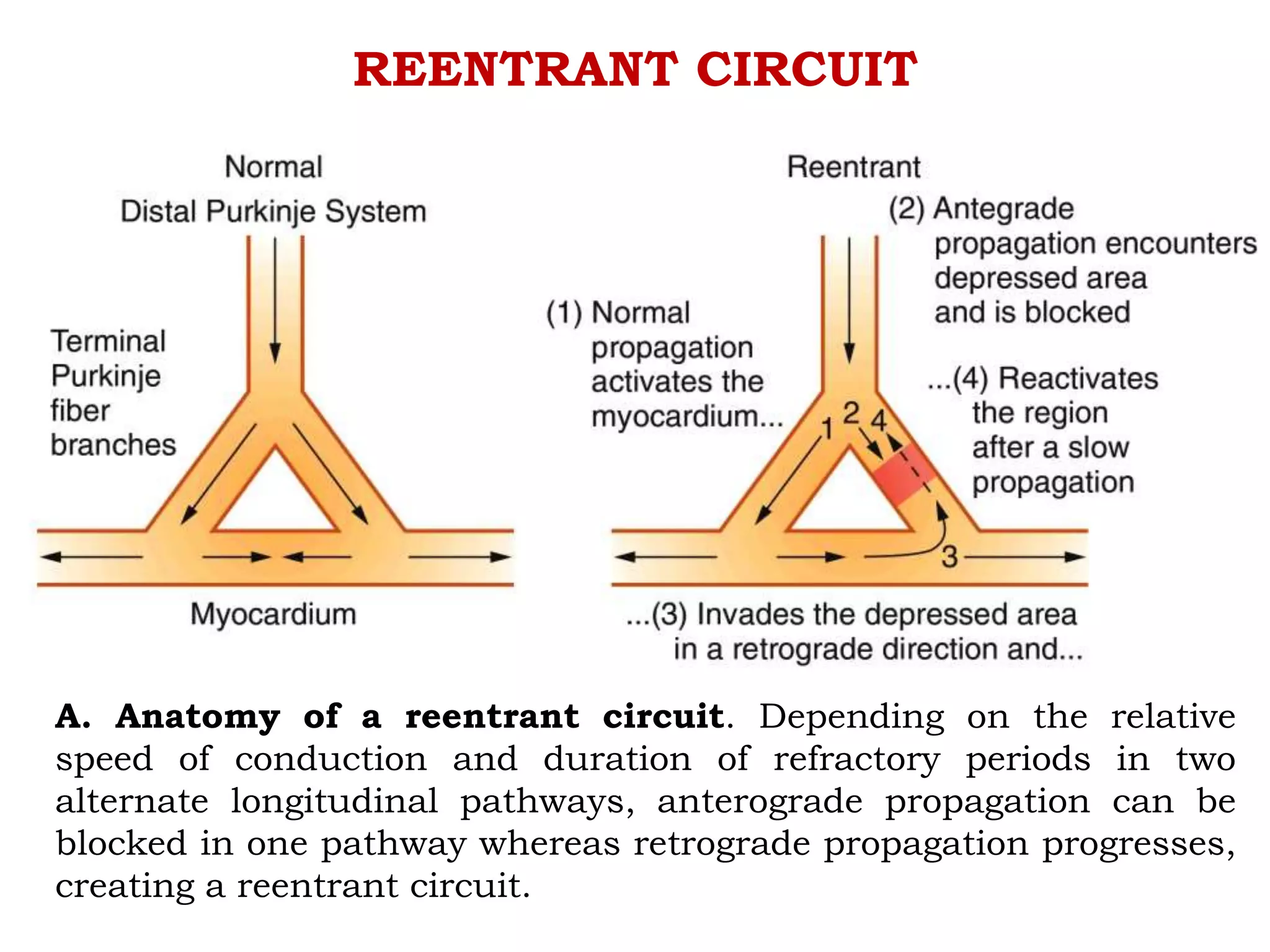Antiarrhythmic drugs, Drugs used in arrhythmia | PPT