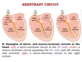 Antiarrhythmic drugs, Drugs used in arrhythmia | PPT