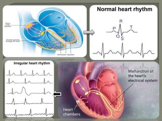 Drugs Used in the Treatment of Arrhythmia | PPTX