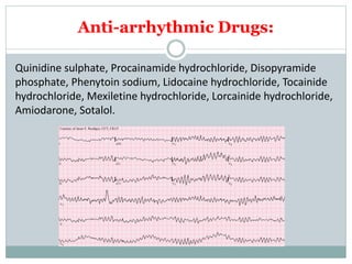 Antiarrhythmic drugs 01 | PPT