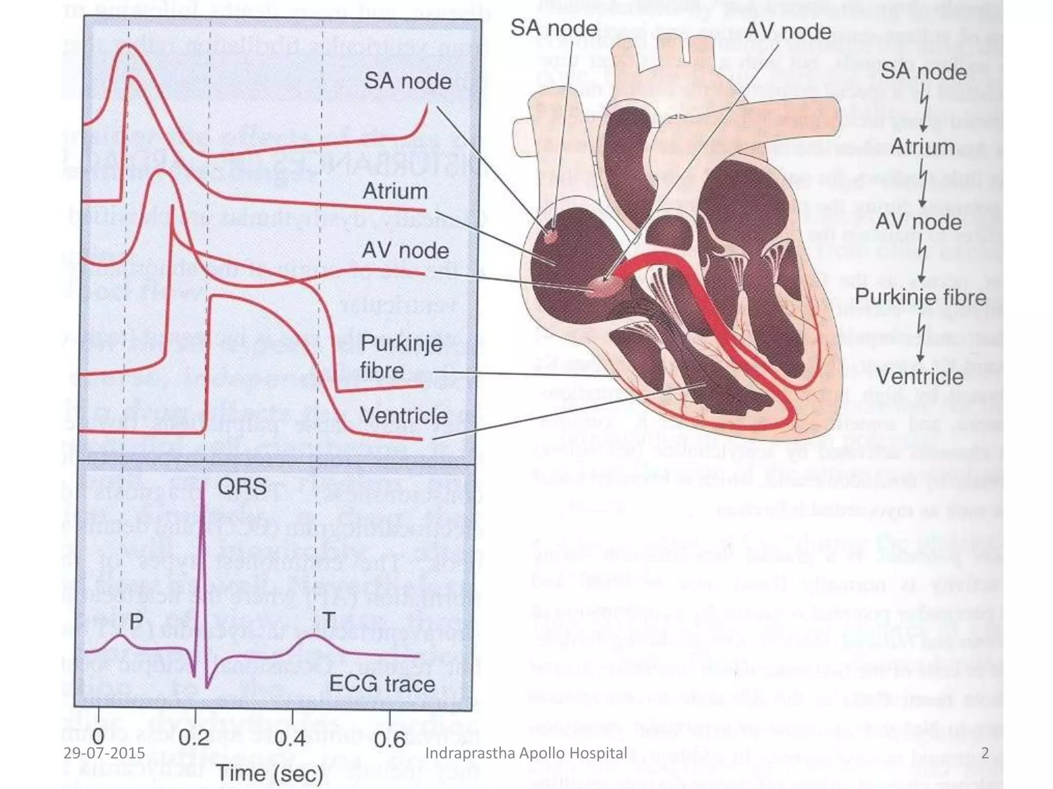 Antiarrhythmic drugs & Anaesthesia for Cardioversion | PPTX