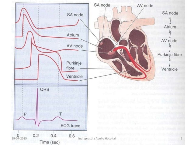 Antiarrhythmic drugs & Anaesthesia for Cardioversion | PPTX