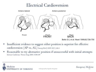Antiarrhythmic drugs & Anaesthesia for Cardioversion | PPTX