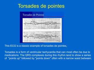 Antiarrhythmic drugs class Bidya.pdf