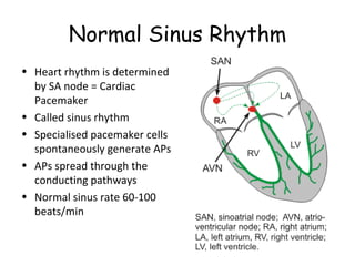 Antiarrhythmics modified | PPT