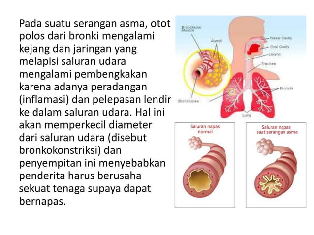 Anti asma | PPT