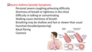 Antiasthmatic presentation | ODP