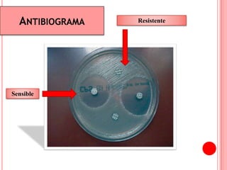 Antibiograma.ppt