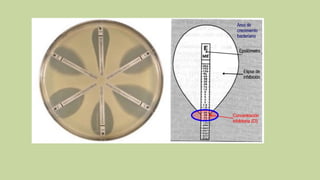 Comprehensive Guide to Antibiogram Methods and Interpretation in ...