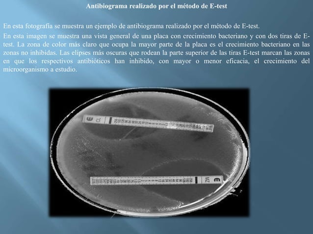 Antibiograma presentacion | PPTX