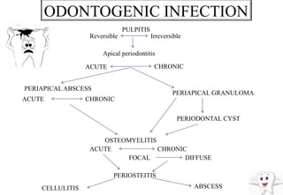 Antibiotic in endodontic | PPTX