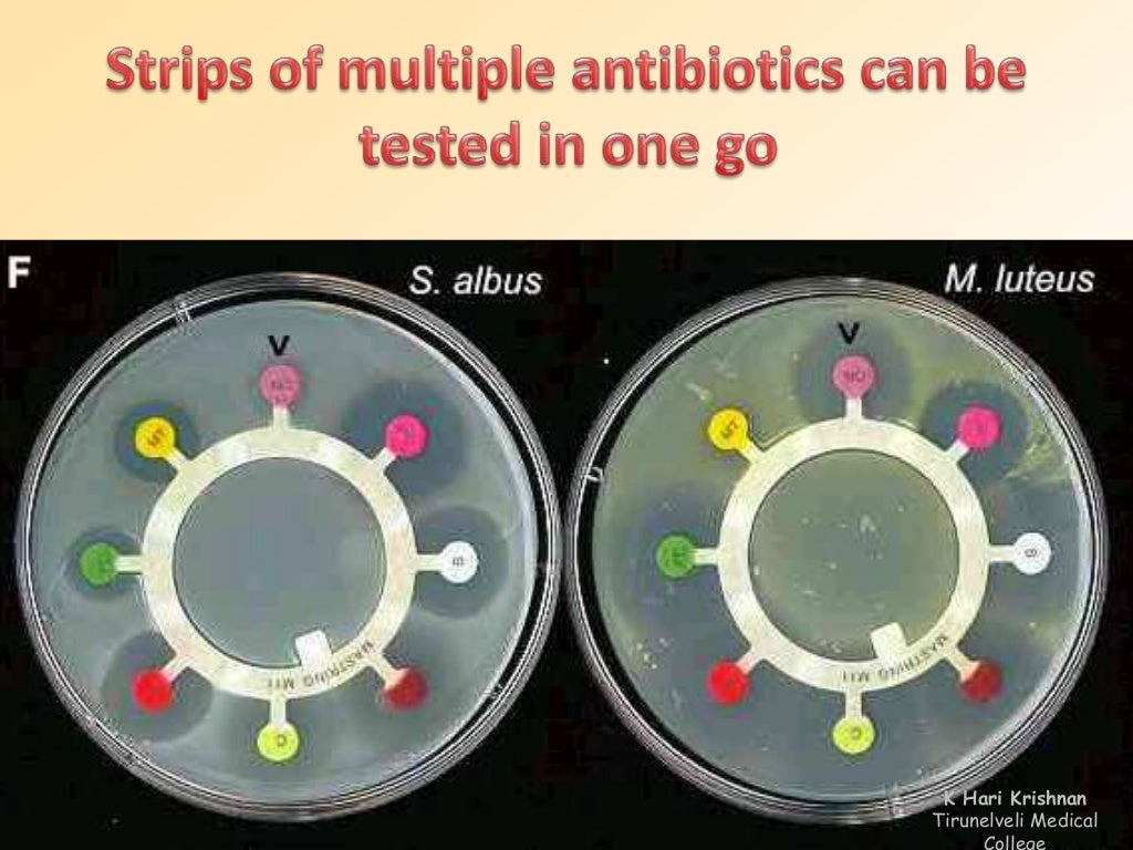Antibiotic Sensitivity Tests