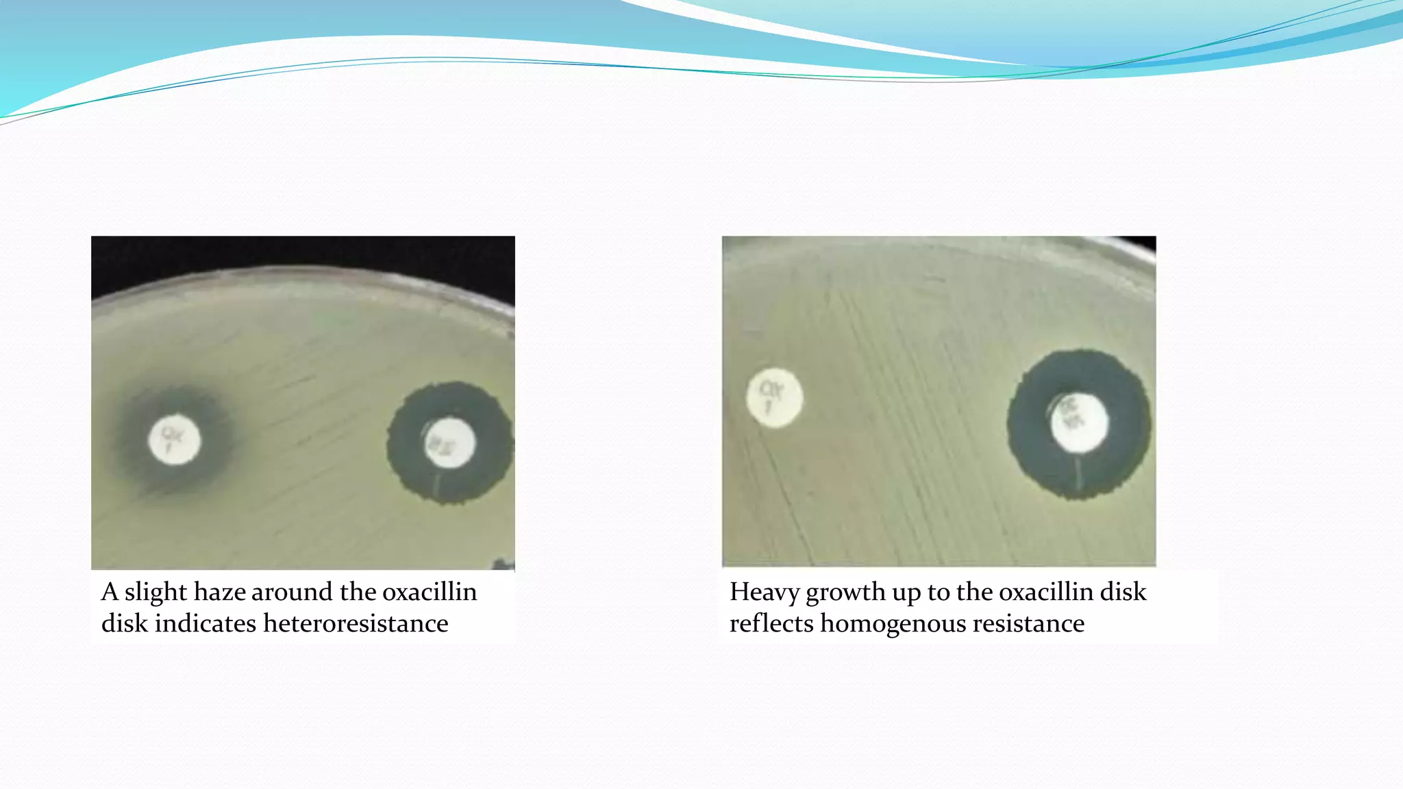 Antibiotic sensitivity testing | PPTX