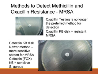 Antibiotic Senstivity Testing 2017 Update | PPT