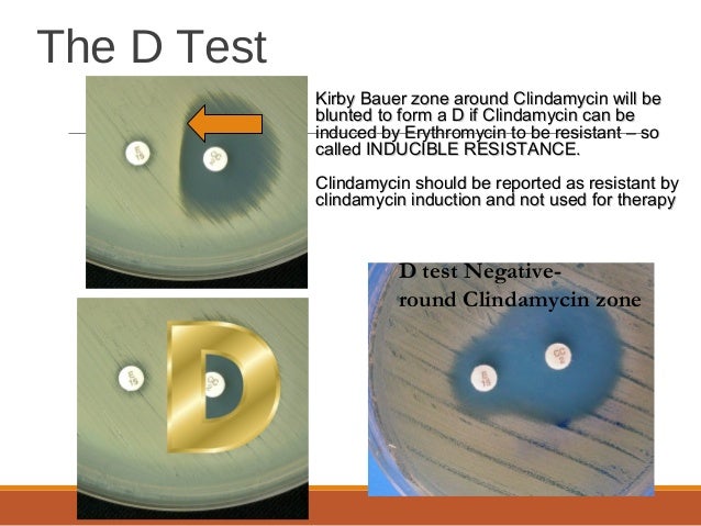 Antibiotic Senstivity Testing 2017 Update