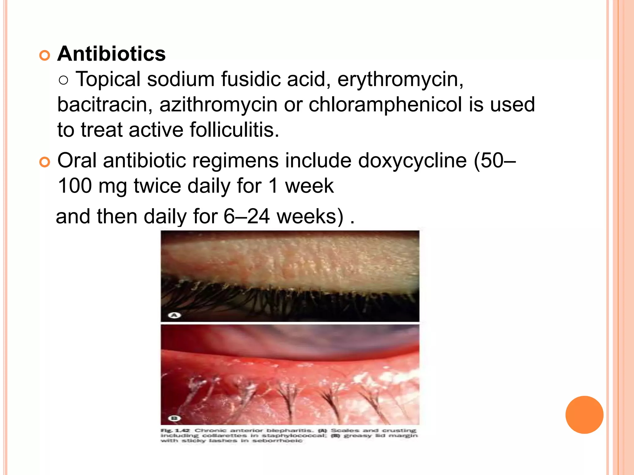 Antibiotics in ophthalmology | PPTX