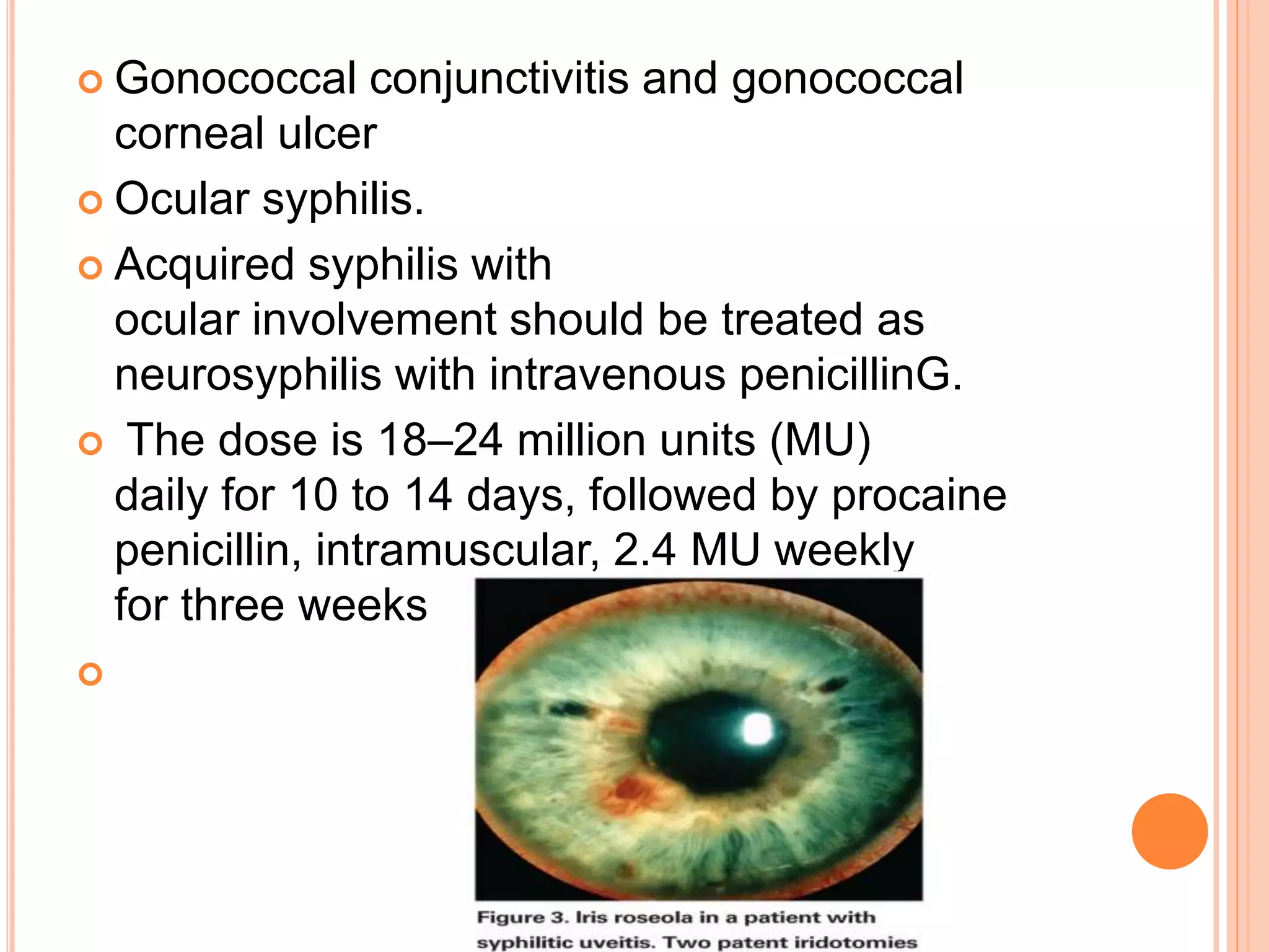 Antibiotics in ophthalmology | PPTX