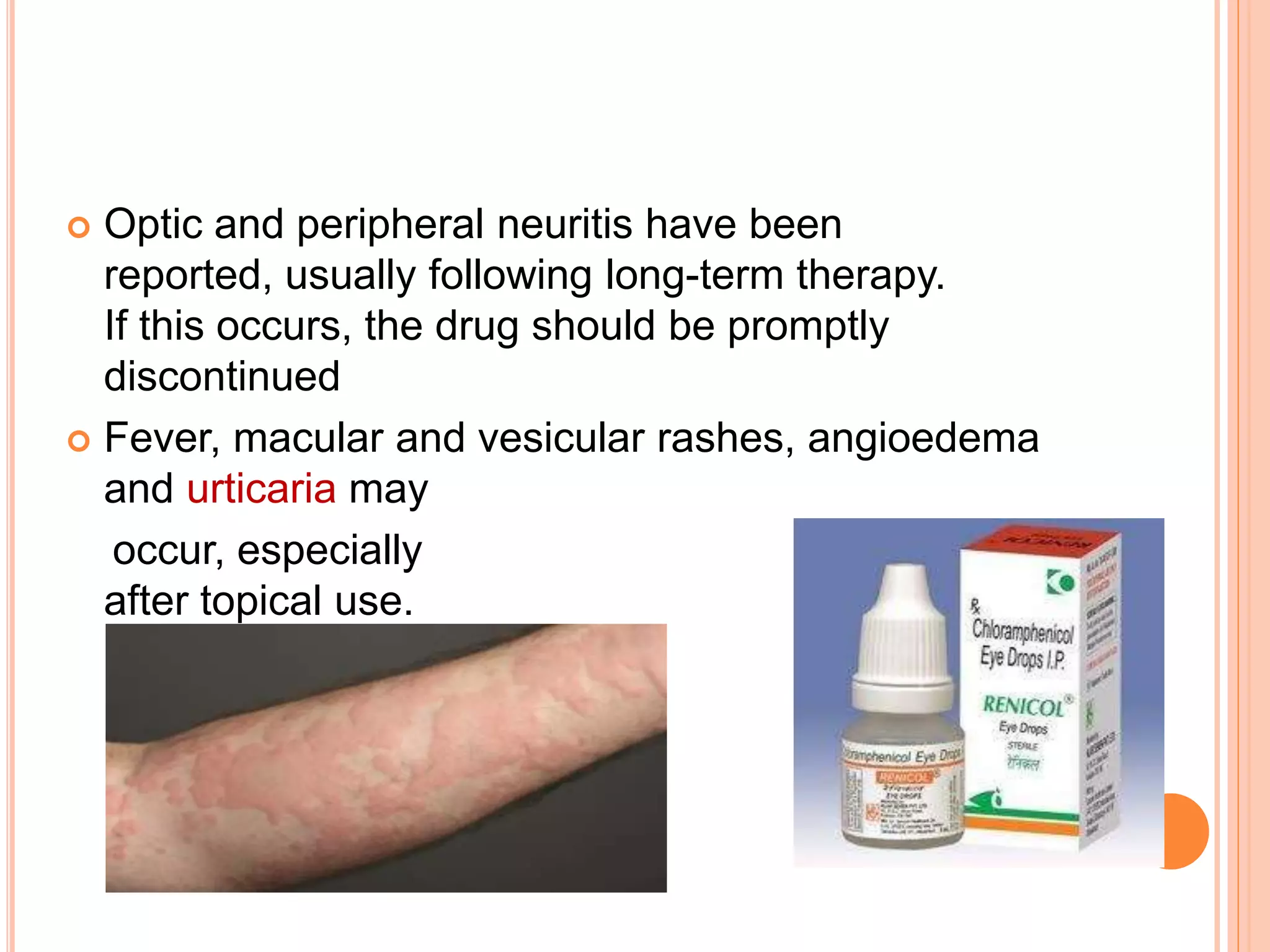 Antibiotics in ophthalmology | PPTX