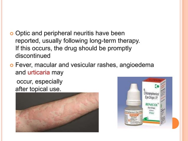 Antibiotics in ophthalmology | PPTX | Eye and Vision Conditions ...