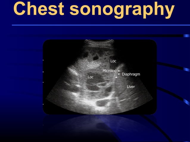 Updates in CAP,HAP, VAP, AECOPD and pneumonia severity scores | PPT ...