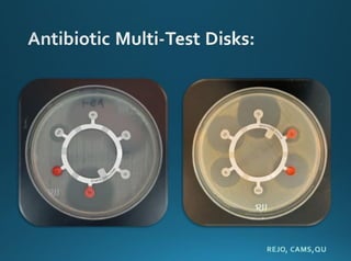 Antibiotic Sensitivity test (AST) | PDF