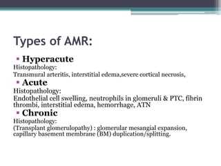 Antibody mediated rejection in kidney transplantation | PPTX