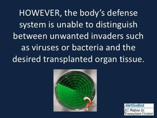 Antibody mediated rejection of solid organ allografts | PPTX