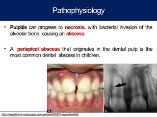 Antiboitics in dental infection for fighting AMR | PPTX