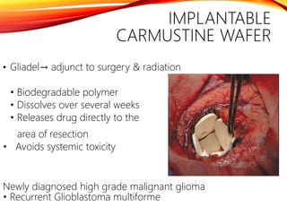 Recent advances in the Anticancer treatment | PPT