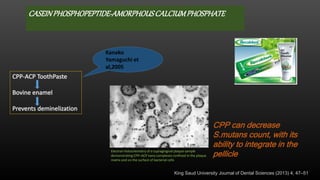 Anticariogenic foods | PPTX