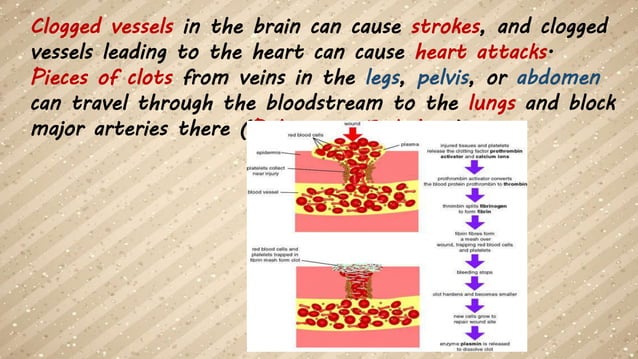 (Anticoagulants / Platelet aggregation inhibitors / Thrombolytic drugs ...