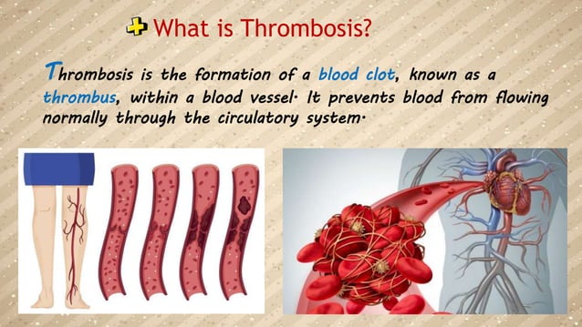 (Anticoagulants / Platelet aggregation inhibitors / Thrombolytic drugs ...