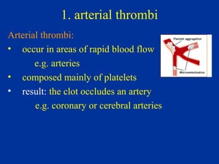 Anticoagulant antiplatelet thrombolytic by Dr. William K Lim | PPT