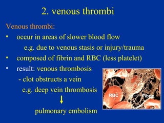 Anticoagulant antiplatelet thrombolytic by Dr. William K Lim | PPT