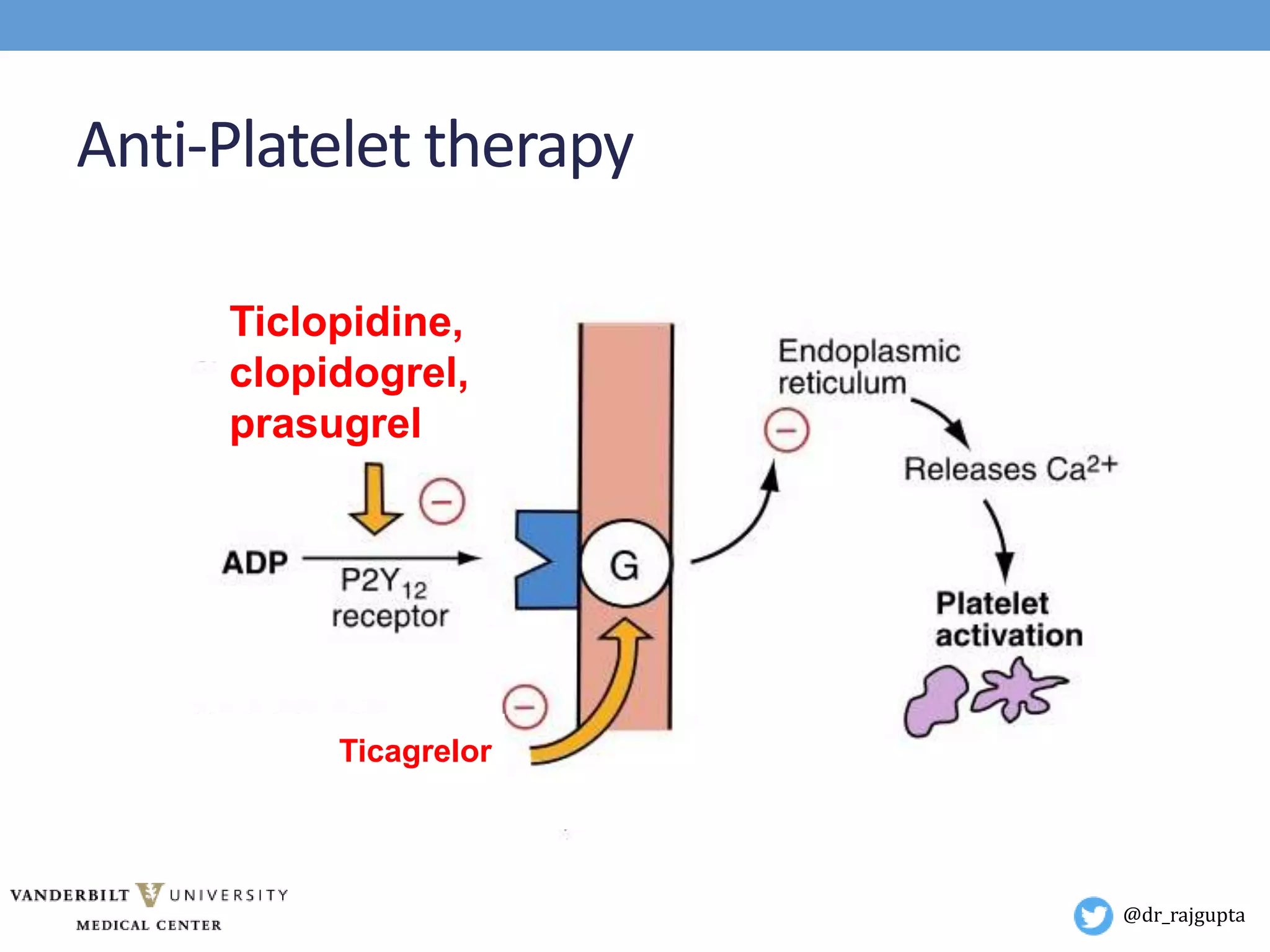 Anticoagulation and Regional Anesthesia | PPTX