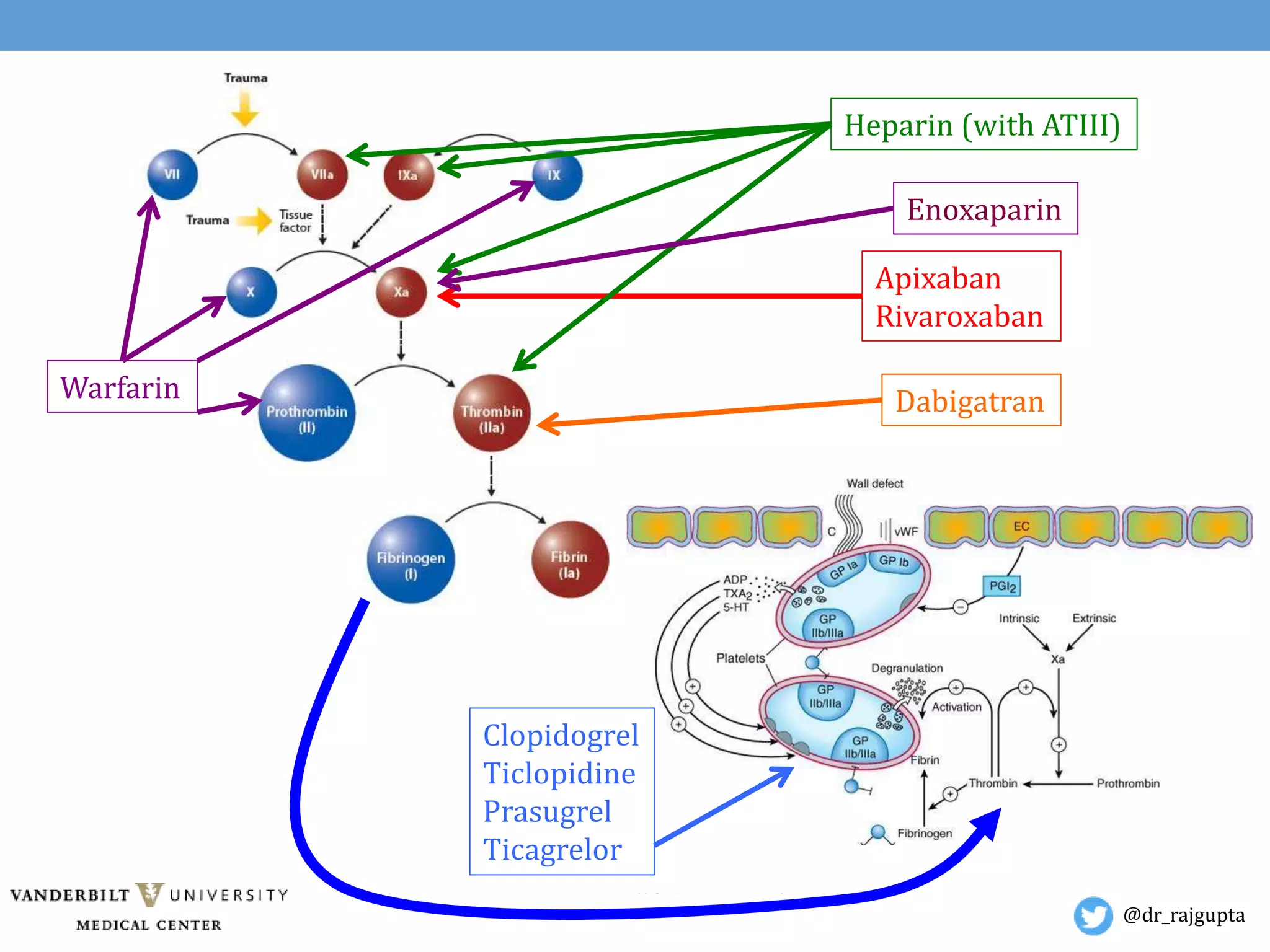 Anticoagulation and Regional Anesthesia | PPTX