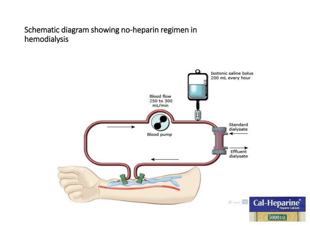 Anticoagulation in hemodialysis | PPTX