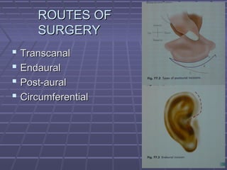 Anticoantral csom | PPT