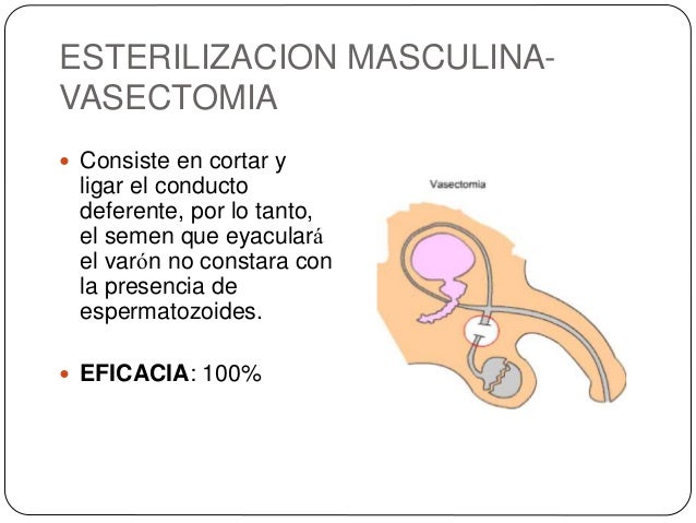 Anticonceptivos