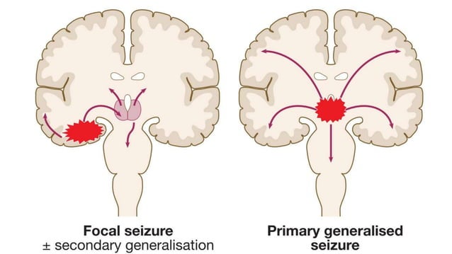 Anti convulsant drugs or drugs or medicine used in convulsion | PPTX