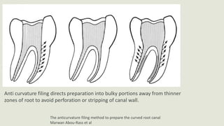 ANTICURVATURE FILING TECHNIQUE ENDO.pptx