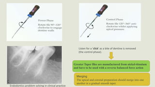 ANTICURVATURE FILING TECHNIQUE ENDO.pptx