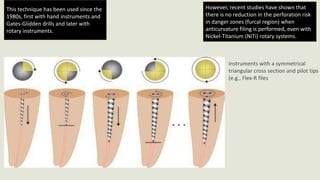 ANTICURVATURE FILING TECHNIQUE ENDO.pptx