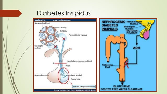Antidiuretics | PPTX | Endocrine and Metabolic Diseases | Diseases and ...