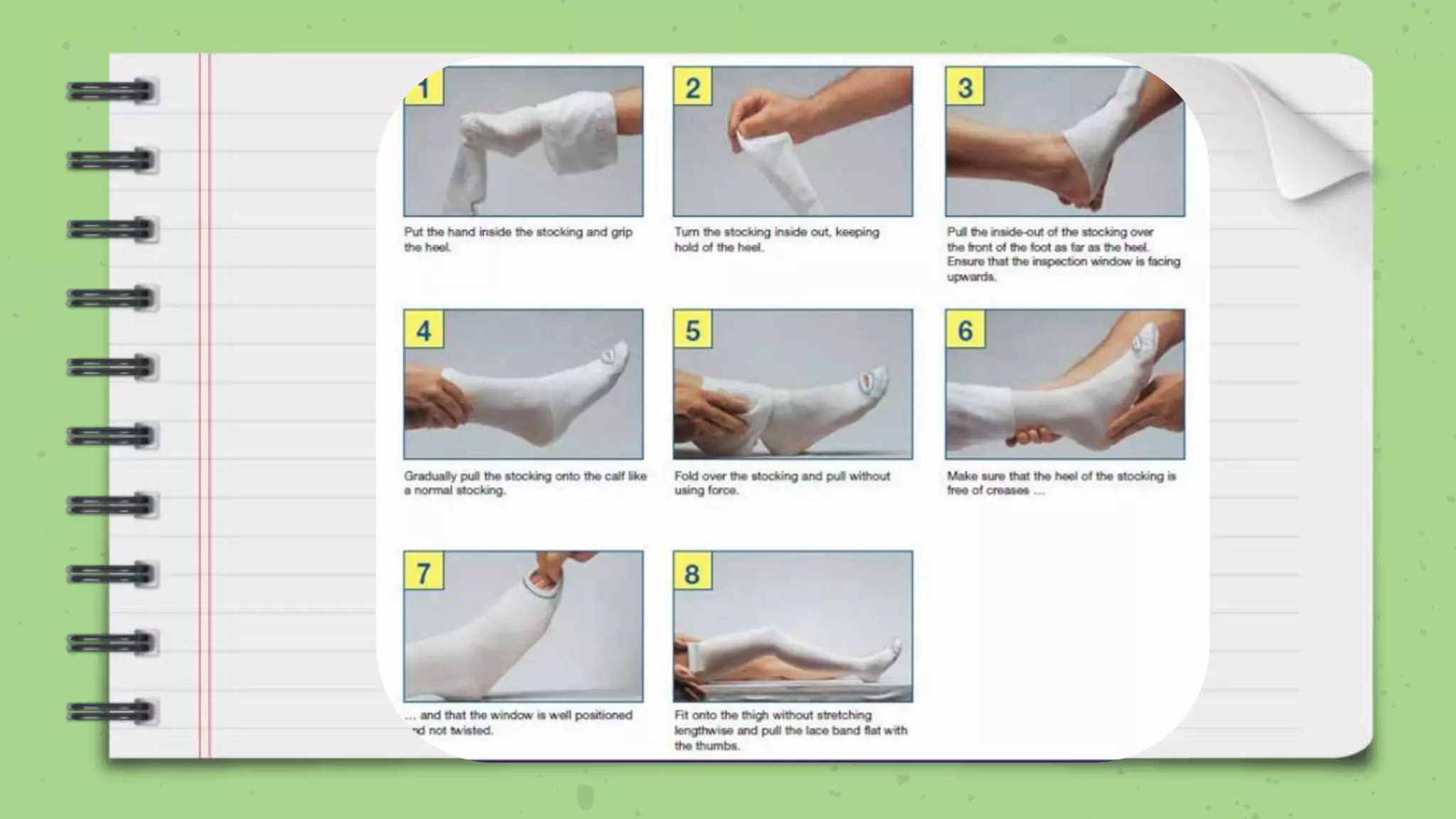 ANTI EMBOLIC STOCKING APPLICATION.pptx